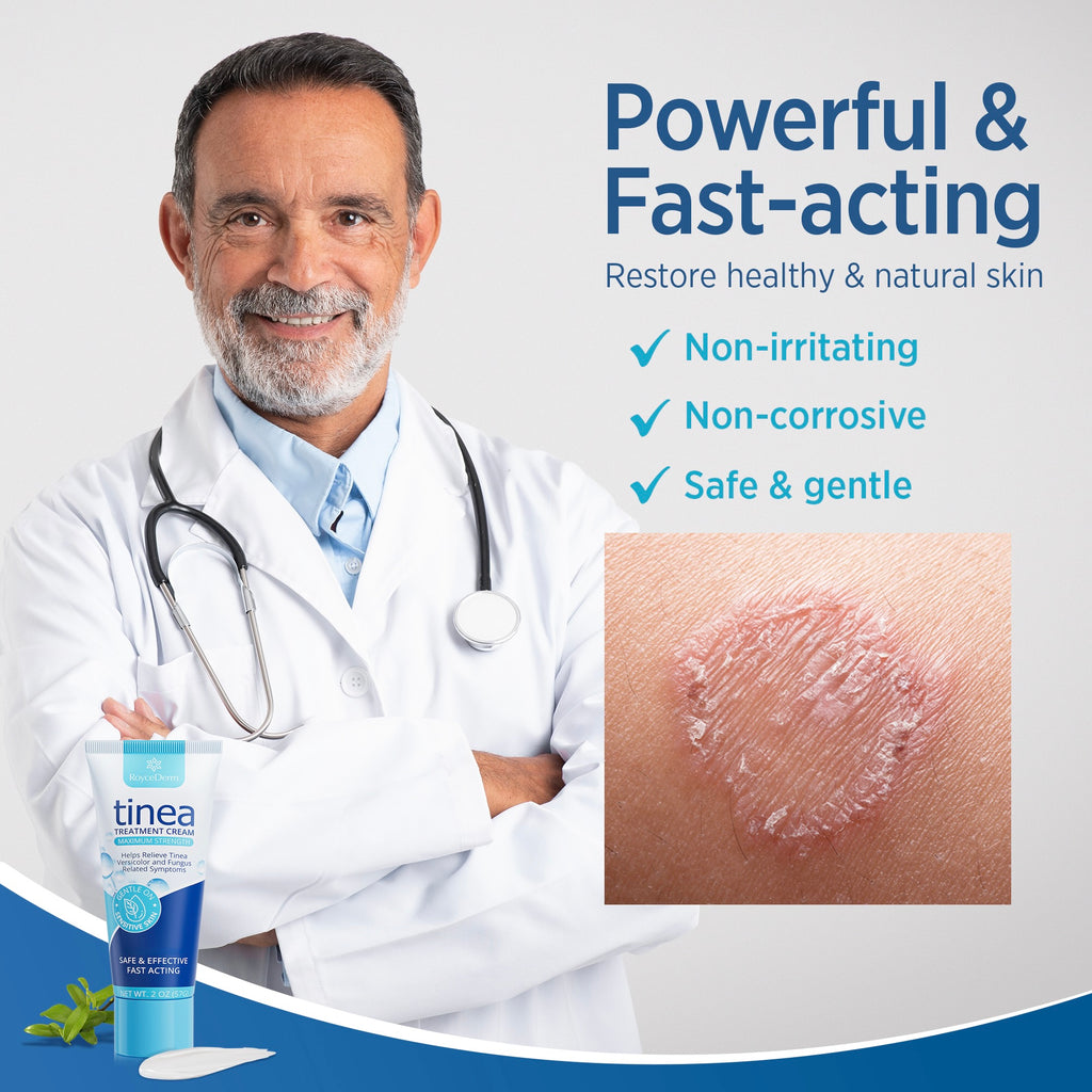Tinea Treatment Cream