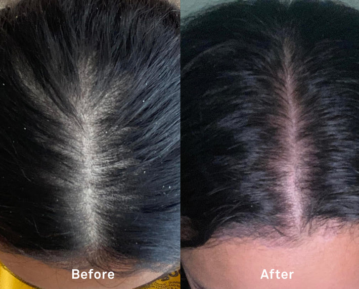 Roycederm | Advanced Anti-Fungal & Skin Care Solutions