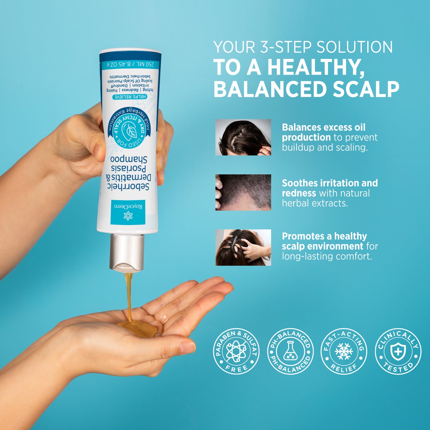 Psoriasis & Seborrheic Dermatitis Shampoo – Roycederm