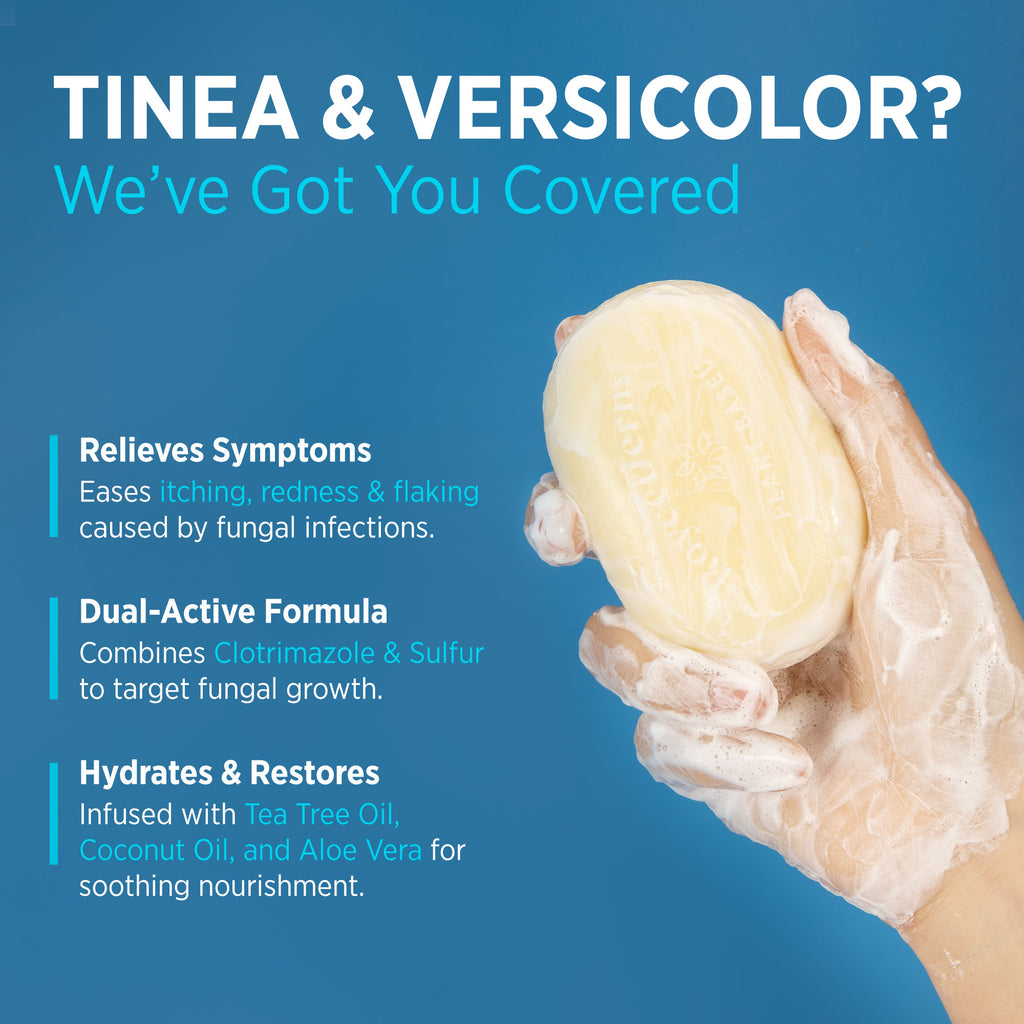 Tinea Versicolor Soap
